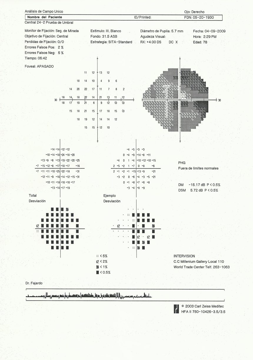 Campo Visual – Intervisión